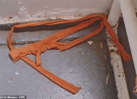 Graphic Photos From Jeffrey Epsteins Autopsy Reveal His Bloodied Neck
