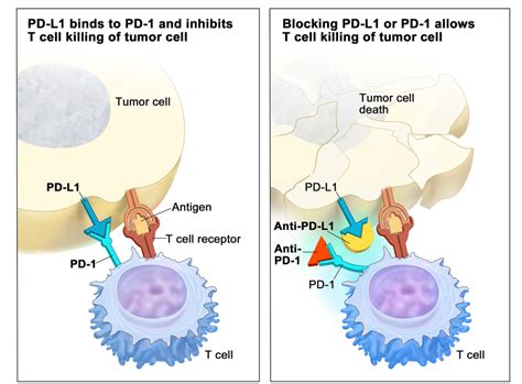 Figure 1 From Review Of Pd 1 Pd L1 Inhibitors In Metastatic Dmmr Msi H Colorectal Cancer