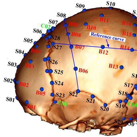 Skull Thickness Distribution By Age The Models Shown Here Were Download Scientific Diagram