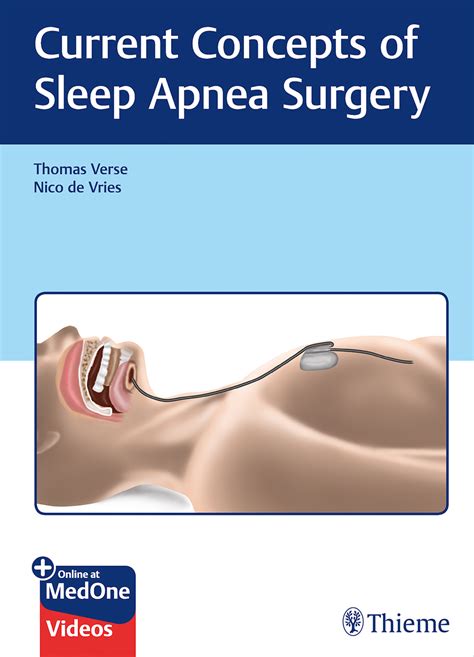 Current Concepts Of Sleep Apnea Surgery The Journal Of Laryngology