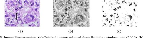 Figure 2 From An Algorithm For The Automatic Detection Of Abnormal