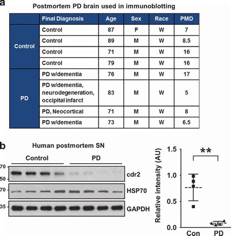 Downregulation Of Cdr2 In Brains From Post Mortem Pd Patients A