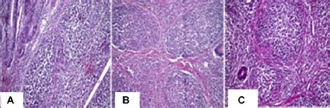Histopathological Sections Of Cecal Tonsils A Group C Severe