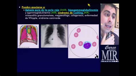 Clase de neumología Dr Abel García del Egido YouTube