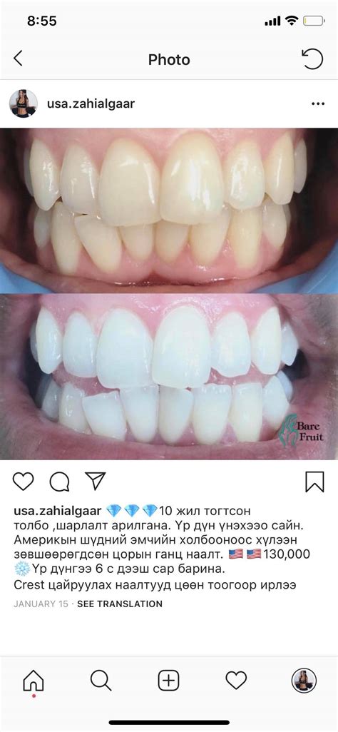 Nes Aesthetic And Dermatology Clinic Арьс гоо заслын эмнэлэг Биотин Biotin тарилга 🥰Биотин