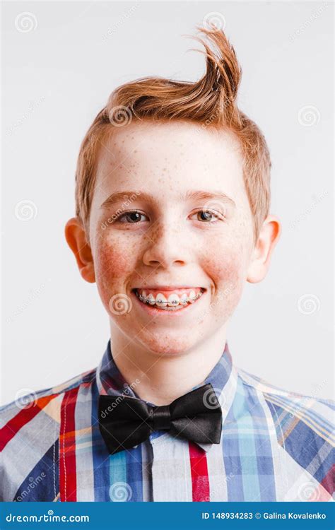 Red Haired Nerd With Braces And Glasses On A White Background Stock