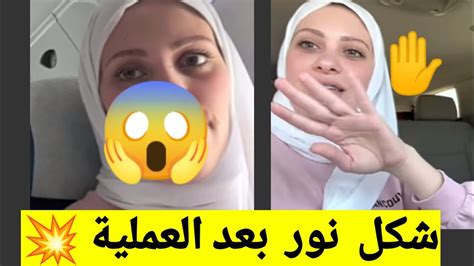 شكل نور بعد العملية 💥 كيف يتحول شكل نور مقداد بعد العملية Youtube