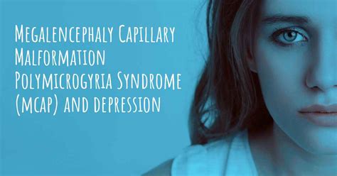 Megalencephaly Capillary Malformation Polymicrogyria Syndrome Mcap