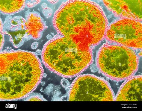 False Colour Transmission Electron Micrograph Of The Gram Negative Bacteria Neisseria