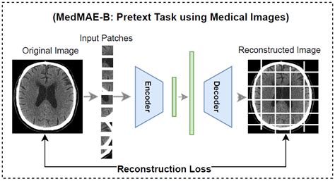 Self Supervised Learning For Medical Image Data With Anatomy Oriented