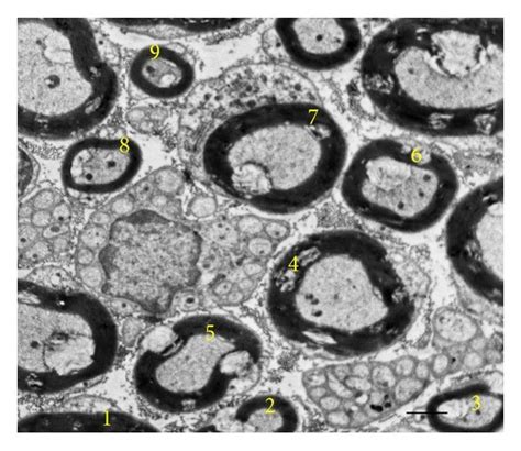 Electron Microscopy A B Representative Electron Micrographs Of The