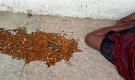 Shocking Abomination Lizard Allegedly Comes Out From A Pregnant Woman