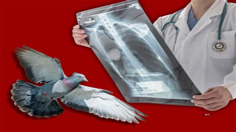 Bird Lung Disease