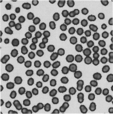 Figure 1 From Self Replicating Spots In Reaction Diffusion Systems Semantic Scholar