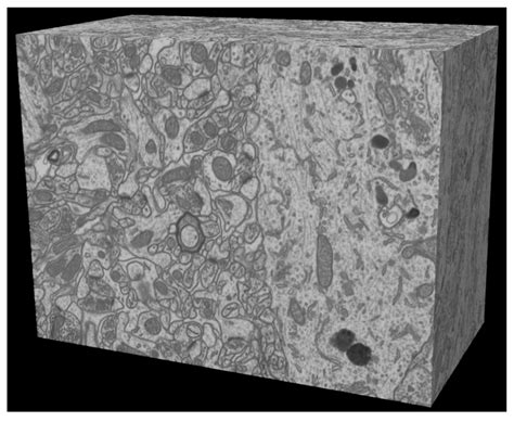 Electronics Free Full Text Two Stage Cascaded Cnn Model For 3d Mitochondria Em Segmentation