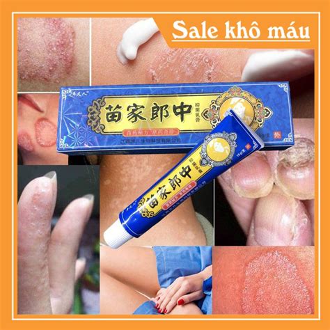 [green Cream] Ringworm Itchy Fungus Horny Sweetener Green Shop Shopee Malaysia