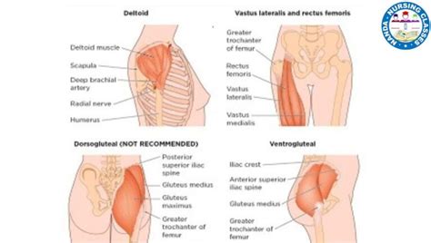 Intramuscular Injection Procedure Nanda Nursing Classes