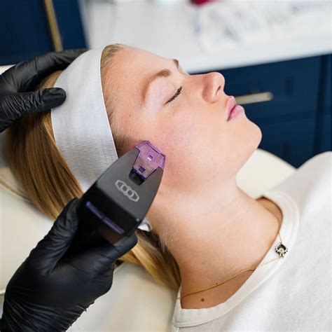 Laser Treatment Face Artofit
