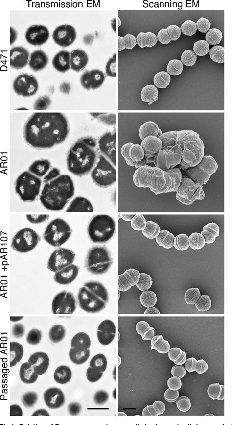 Figure 1 From Streptococcus Pyogenes Sortase Mutants Are Highly Susceptible To Killing By Host
