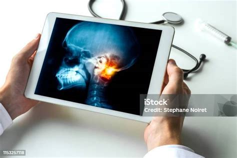 Dokter Menonton Rontgen Rasa Sakit Di Leher Tengkorak Di Tablet Digital