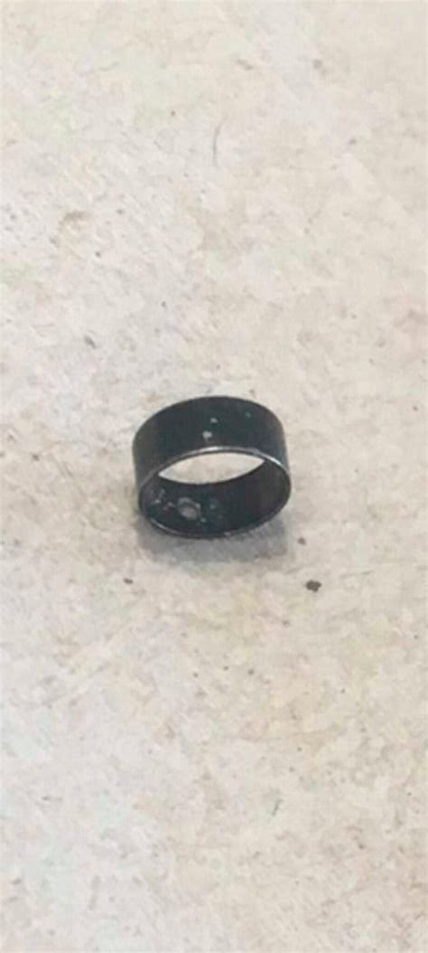 Quand Une Opération De Lappendicite Vire Au Cauchemar Ma Vie Est