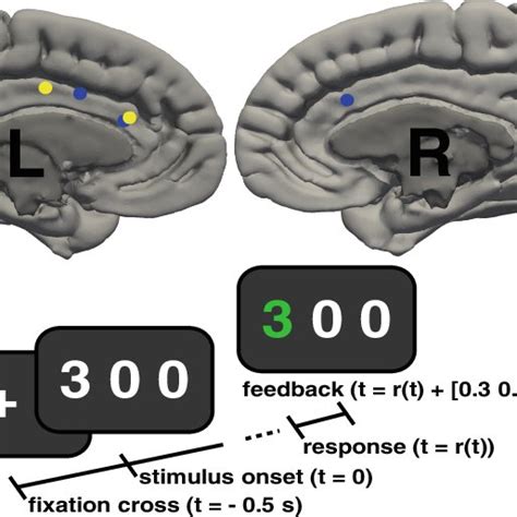 1 Msit Task And Microwire Recording Locations A Microwire Recording