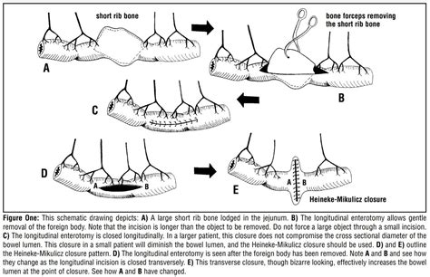 Enterotomy Surgical Procedure