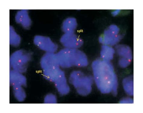 Abnova™ Fgfr1 Split Fish Probe 100 μl Fisher Scientific