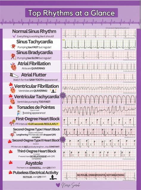 Best 13 Nih Stroke Scale Nihss Modified Nihss Mnihss Artofit