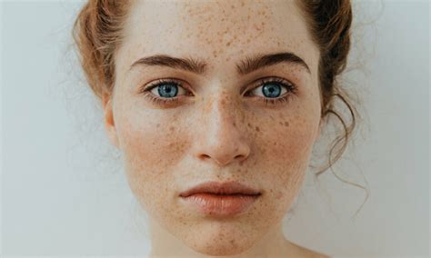 Unveiling The Wonders Of Pico Laser Redefining Medical Aesthetics Health Plethora