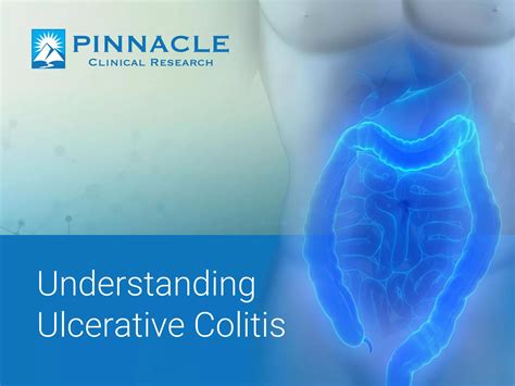 Understanding Ulcerative Colitis PPT