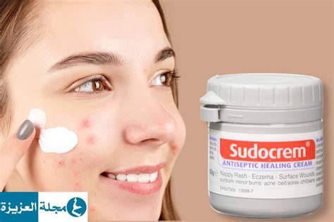 هل يُستخدم سودو كريم للحبوب حقاً؟ اعرفي رأي الأطباء وأهم بدائله مجلة