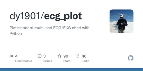 Github Dy1901ecgplot Plot Standard Multi Lead Ecgekg Chart With