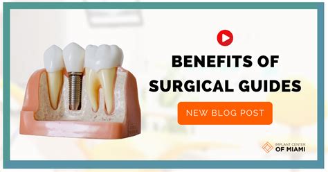 Ada Code For All On 4 Denture Explained