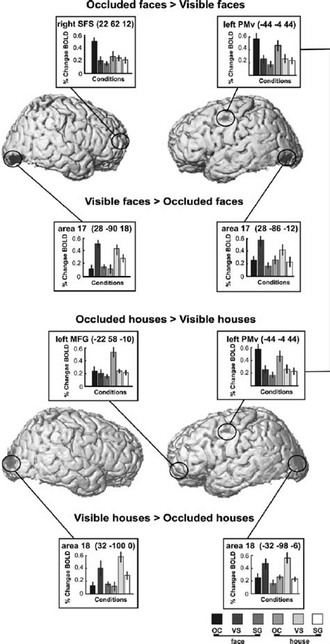 Upper Diagram Shows Brain Activity Common To Occluded Faces And Houses