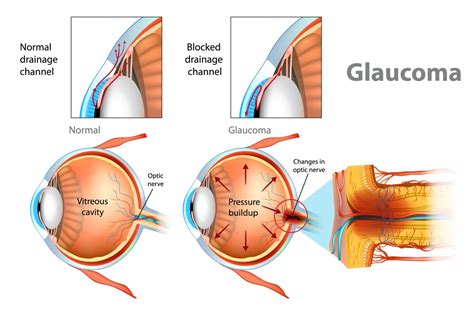 Anatomy Of Visual Pathway Optography