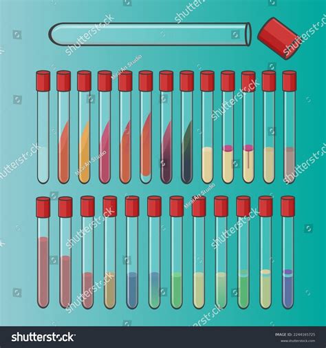Test Tube Some Bacteria Biochemical Test Stock Vector Royalty Free 2244165725 Shutterstock