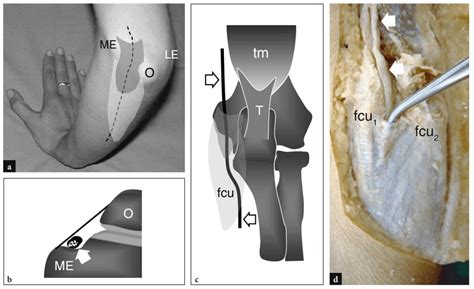 Anatomía De La Superficie Del Codo Articulación Del Codo Anatomía