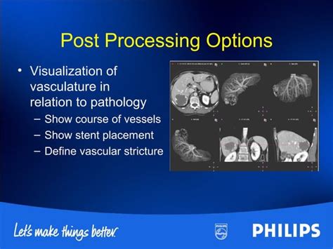 Basic Principles Of Ct Scanning PPT Medical Tests Medical Health