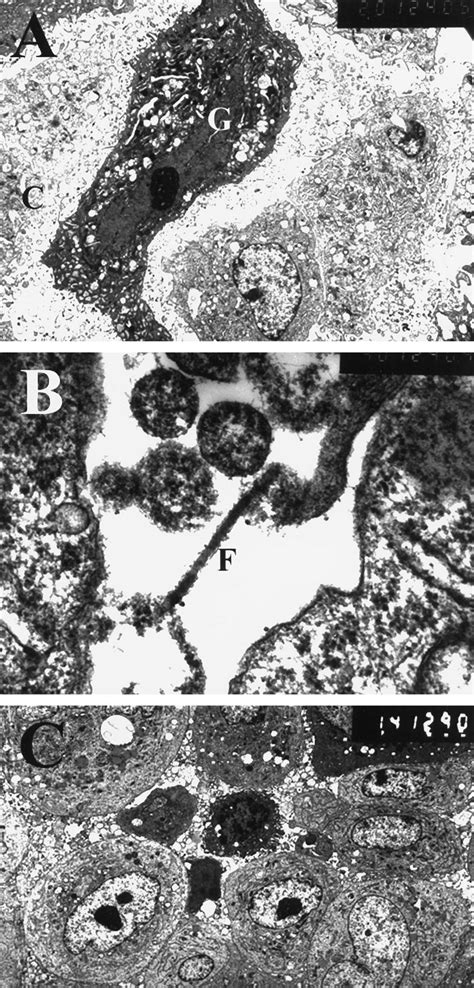 Electron Micrographs Of Primary And Cocultured Fibroblast Cells A