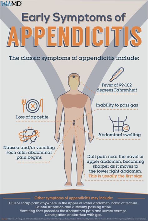Appendicitis Is Almost Always A Medical Emergency That Requires Prompt Surgery To Remove The