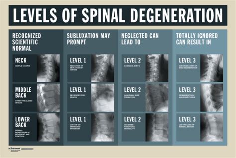 Mri Spine Anatomy Free Mri Lumbar Spine Sagittal Cross Sectional