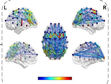 研一脑电小白进阶版 之 使用brainnet viewer构建脑功能网络图 csdn博客