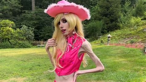 Anorexic Youtuber Eugenia Cooney 29 Sparks A Wave Of Concern Over Her Rail Thin Appearance In