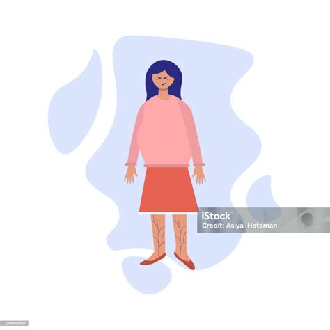 임신 증상 및 문제 개념 정맥류로 고통받는 젊은 임산부 건강에 문제가 나쁜 평면 일러스트를 느낌 일러스트레이션에 대한 스톡 벡터