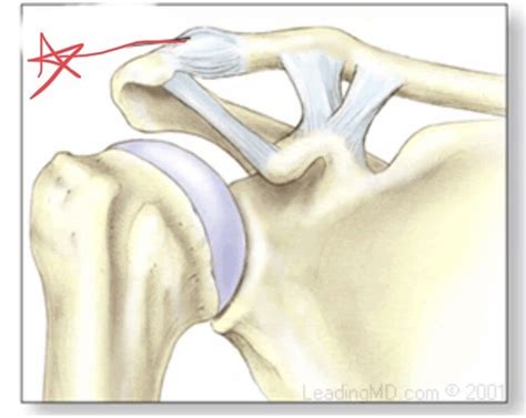 Exs 216l Flashcards Quizlet