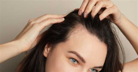Understanding Scalp Health More Than Just Hair Deep Clear 2 Perfection