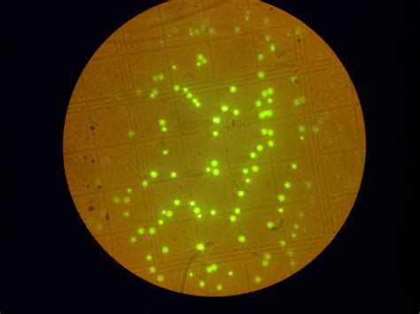 Counting Chamber For Bacteria