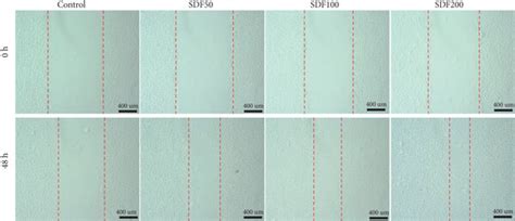 Two Dimensional Migration Assay Of Mscs On The Four Groups Of Download Scientific Diagram