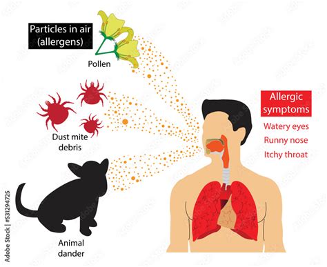 Illustration Of Medical And Pollution Symptoms Of Airborne Allergies